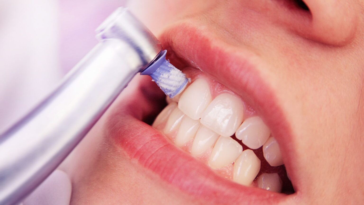 Adiós a las limpiezas en el dentista: elimina el sarro de tus dientes ...