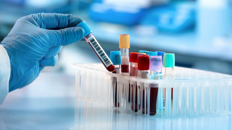 Confirmed by scientists—a new blood type called Emm becomes the rarest ...